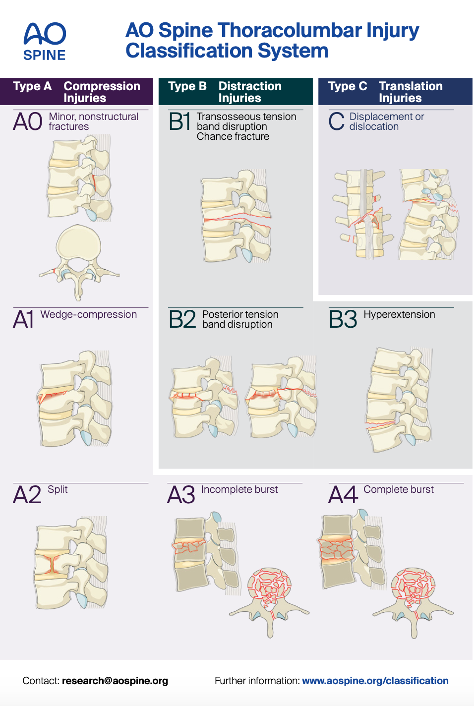 椎体骨折 最近の分類 TLAOSIS | 整形外科診療所